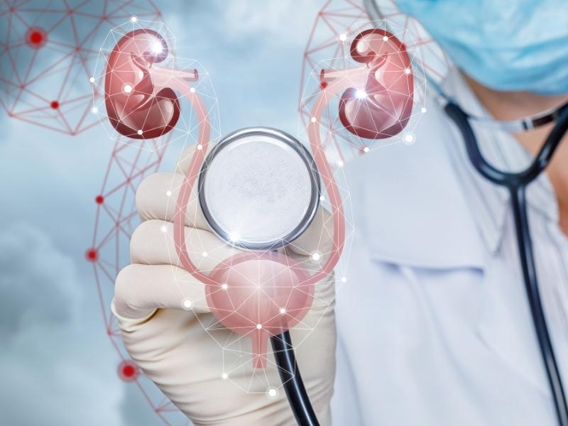 Stent ureterale: a cosa serve e come viene posizionato